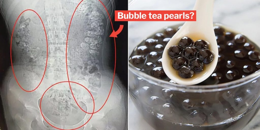 14-Year-Old Girl Complains Of Abdominal Pains; Doctor Allegedly Finds ...