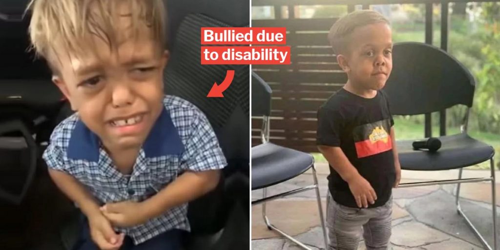 Bullied Kid With Dwarfism Gets Fully Paid Trip To S'pore & Learn ...