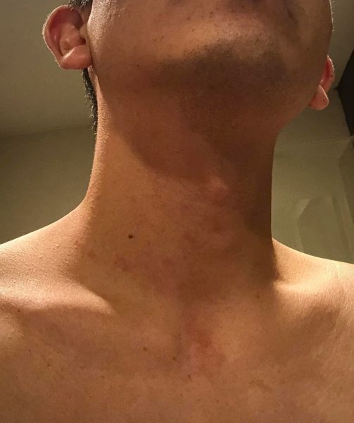 S’poreans Try Prong & Shock Collars To Show Cruelty, Advise Dog Owners ...