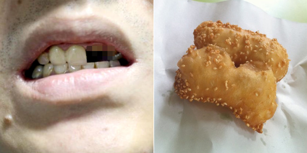 Man Breaks 2 Teeth Chomping On Pebble Inside Bun Bought At NEX, Koufu ...