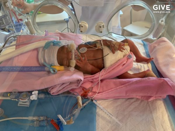 Couple In S'pore Gives Birth To 28-Week-Old Premature Baby, Needs $220K ...