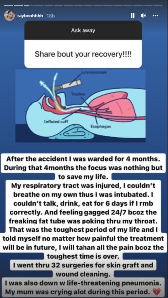 Raybe Oh Doesn't Regret Trying To Save Fiancé From Fire Despite ...