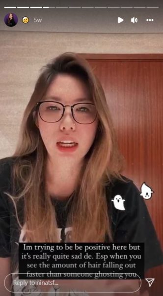 Ex-NOC Talent Nina Tan Opens Up About Alopecia & What It's Like To Lose ...