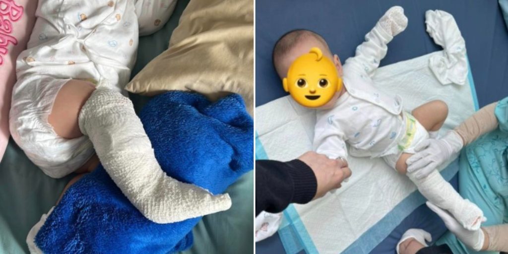 Johor Mum Allegedly Finds 3-Month-Old Son With Broken Leg Under Nanny's ...