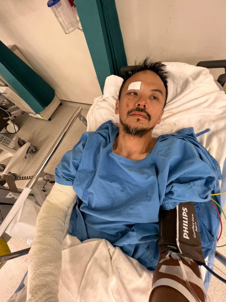 Cyclist Suffers Minor Brain Bleed After Collision With Another Biker At ...