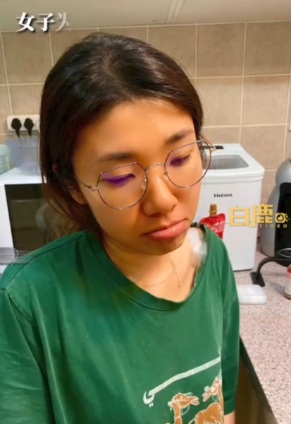Woman In China Turns Orange After Eating Carrots For 3 Months Straight ...