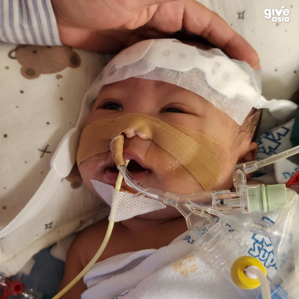 1-Month-Old S’porean Baby With Heart Defect Suffers Stroke, Needs Funds ...