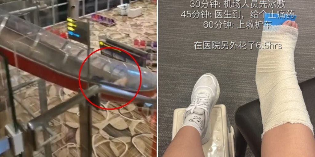 Woman breaks leg going down Changi Airport slide, warns others to play ...