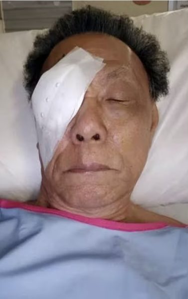 67-year-old man stabbed in the eye by neighbour in Hougang, nearly goes ...