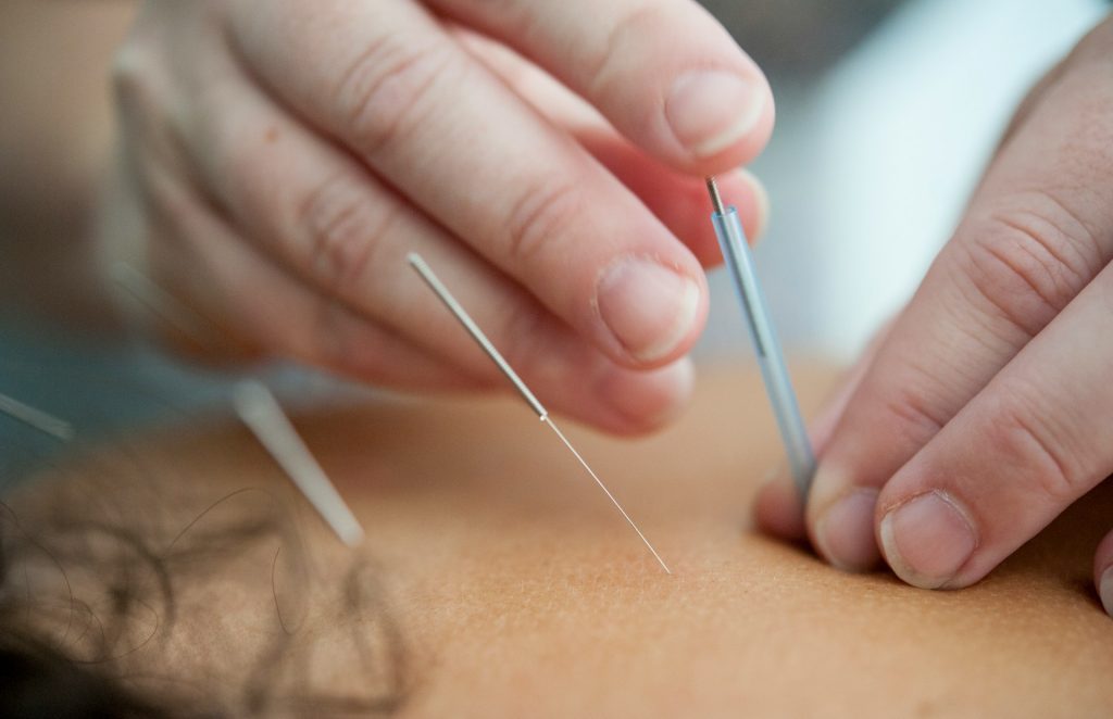 S'pore TCM practitioner fails to remove 2 needles from patient after ...