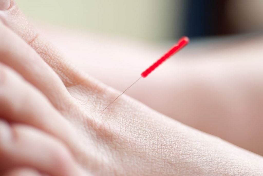 S'pore TCM practitioner fails to remove 2 needles from patient after ...