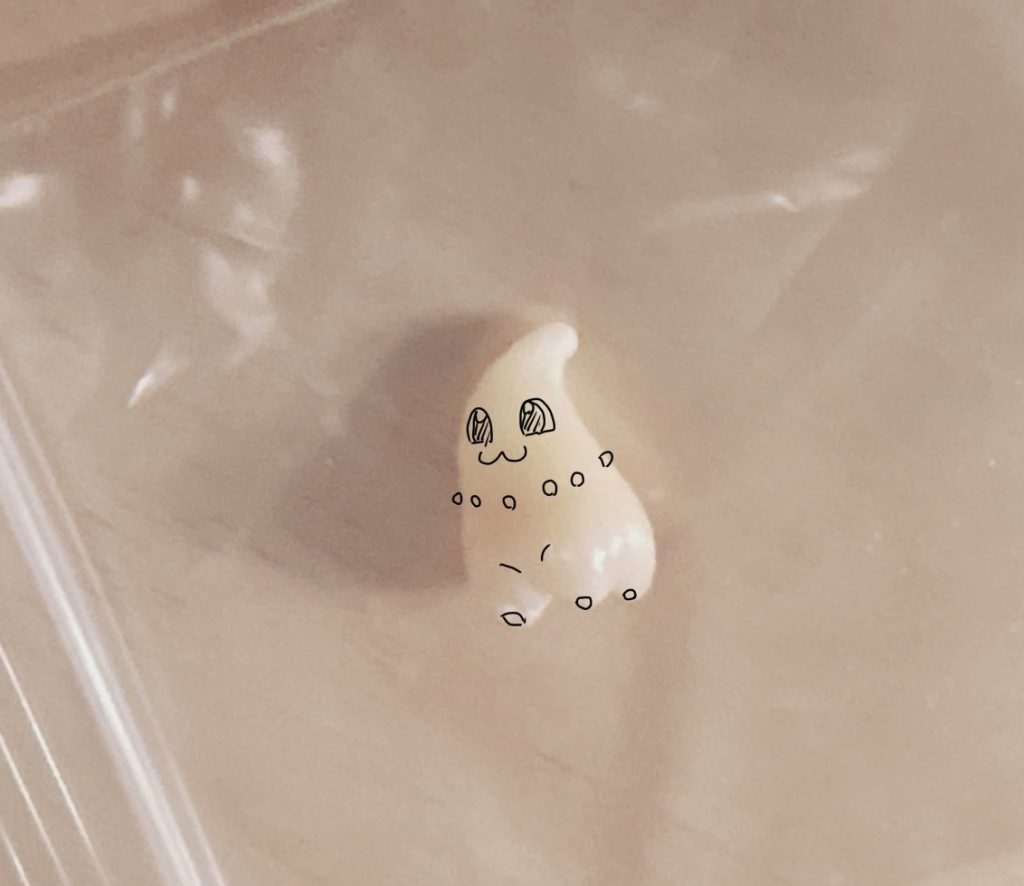Netizen from Japan shares photo of 'cutest' wisdom tooth, prompts ...