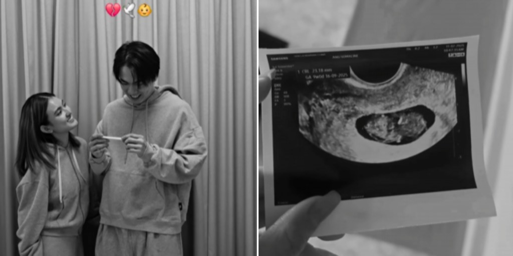 'Overwhelmed by grief': Mediacorp actress Hong Ling lost both her baby ...