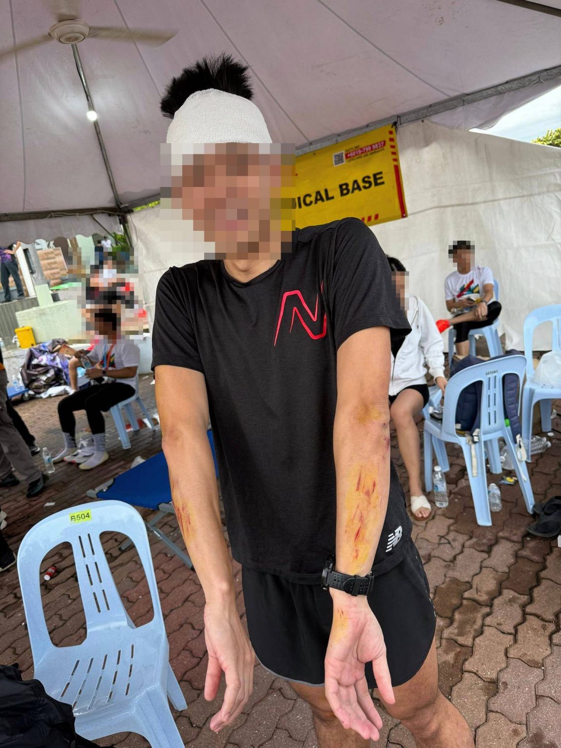 Runner gets 10 stitches on head after hit-and-run accident during ...