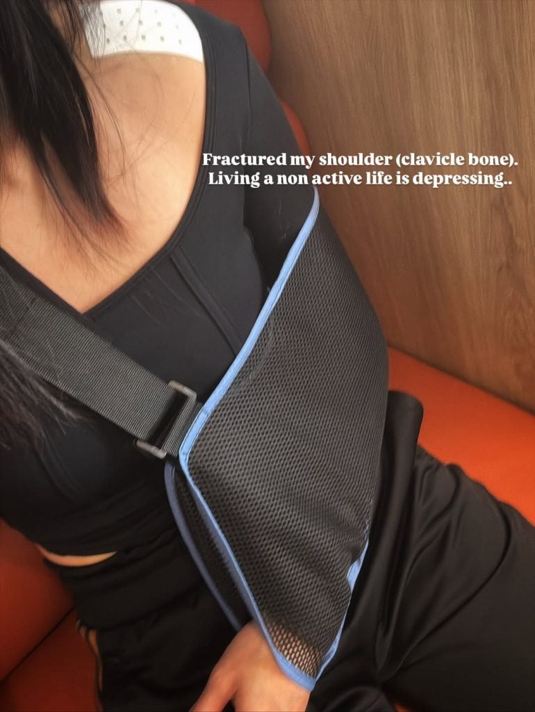 S'pore actress Ferlyn G fractures collarbone, continues filming for ...