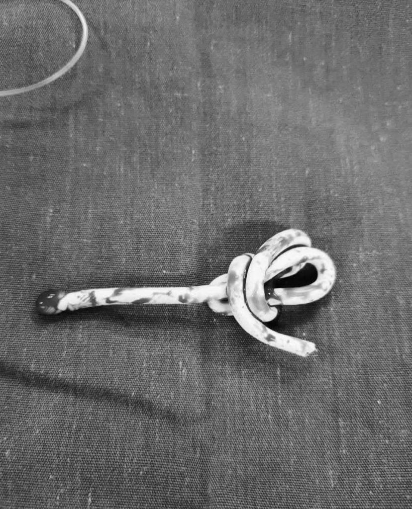 15-year-old boy in Vietnam inserts 35cm cable into urethra after ...